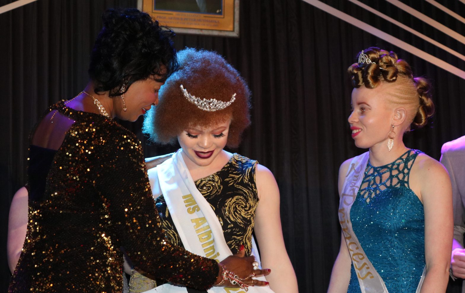 Miss Albinism Malawi beauty queen pledges to uplift lives - Malawi ...